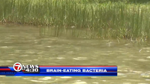 South Florida swimmer suffering from brain-eating amoeba after diving ...