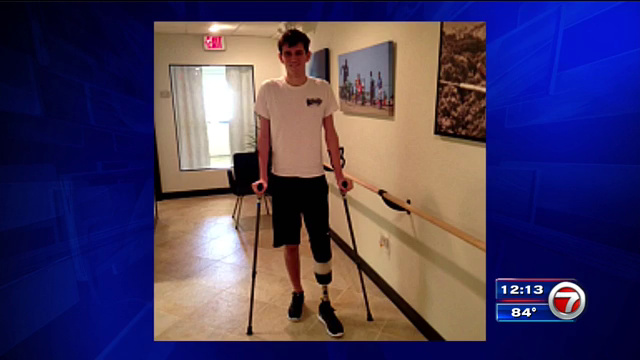 Student returns to UM on new prosthetic leg after 4th of July incident ...