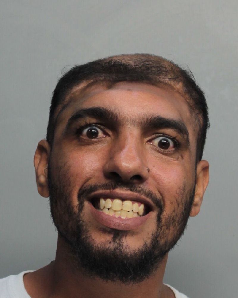 Half-headed man charged after setting mattress on fire - WSVN 7News ...