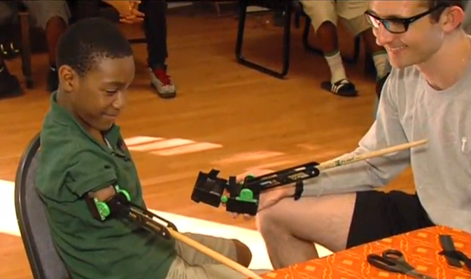 UF students give Palm Beach teen 3-D printed prosthetic limbs - WSVN ...