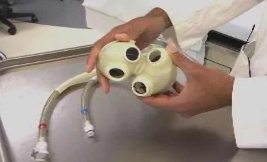 Hospital offers temporary, artificial heart for transplant candidates ...