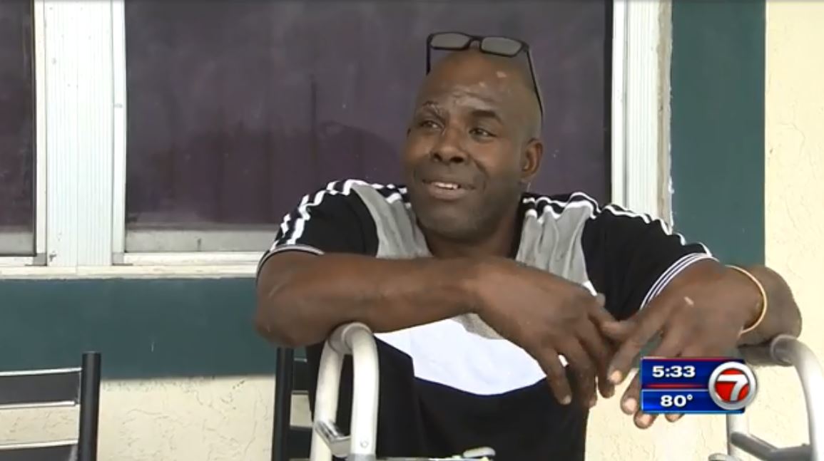 Amputee shares survival story after being involved in hit and run ...