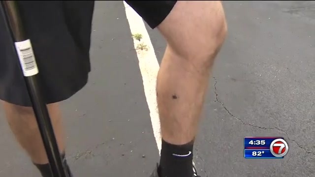 Man speaks out after being shot several times in Lauderhill - WSVN ...