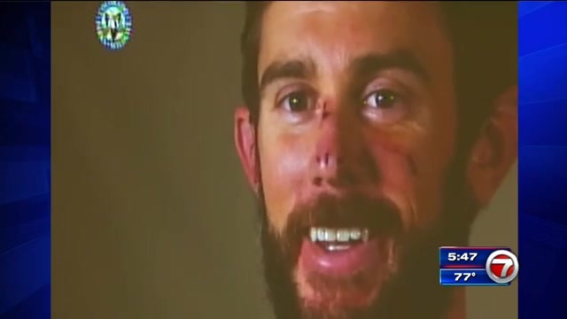 Trail runner recounts life-or-death fight with mountain lion - WSVN ...