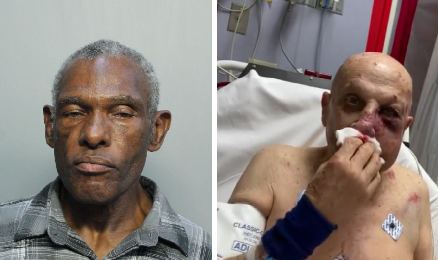 Man accused of attacking elderly man on MetroMover - WSVN 7News | Miami ...