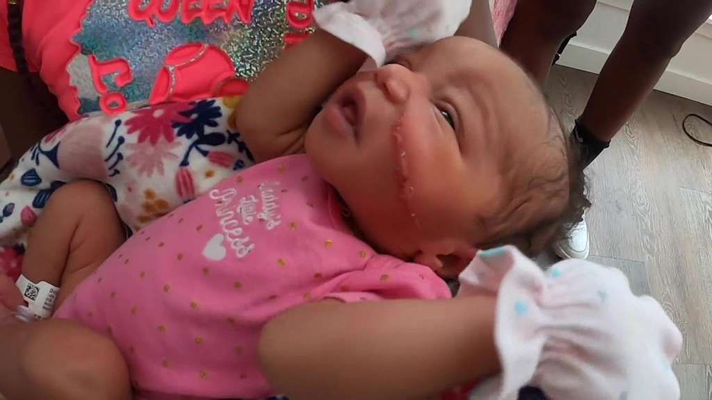 Newborn left with cut on face after emergency c-section – WSVN 7News ...