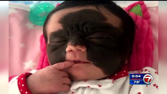 Something to Smile About: South Florida toddler treated in Russia to ...