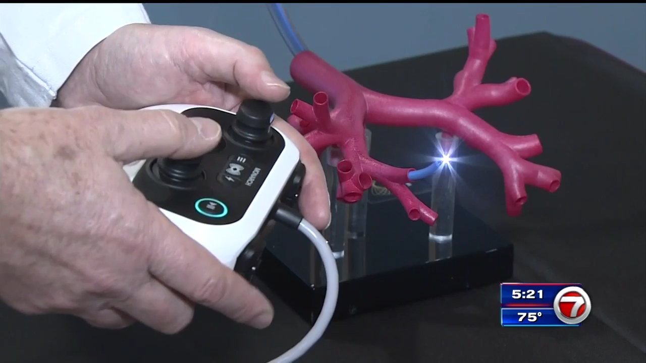 New device helps diagnose lung cancer - WSVN 7News | Miami News ...