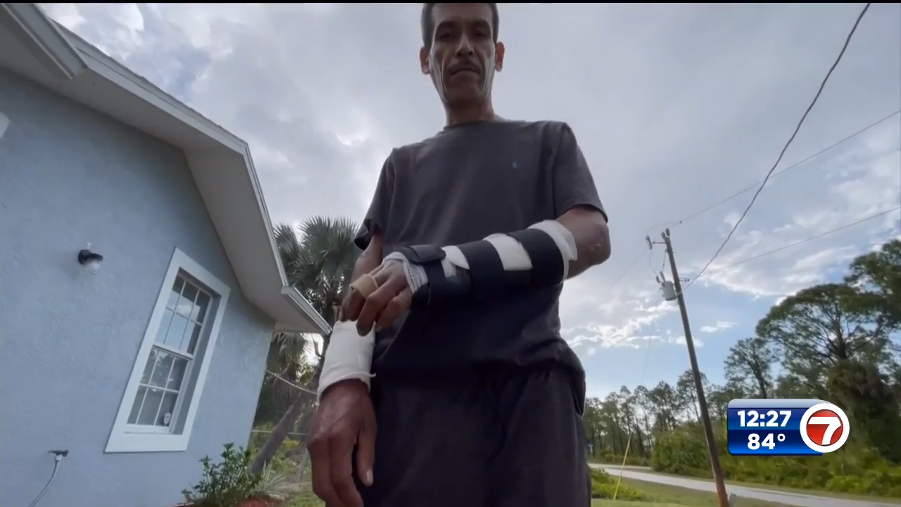 Everglades airboat tour mechanic mauled by two tigers shares ordeal ...