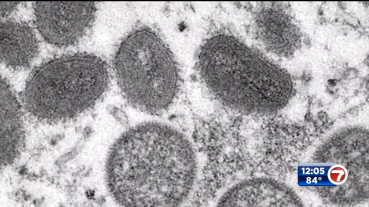 Monkeypox outbreak reaches 257 confirmed cases worldwide, WHO says ...