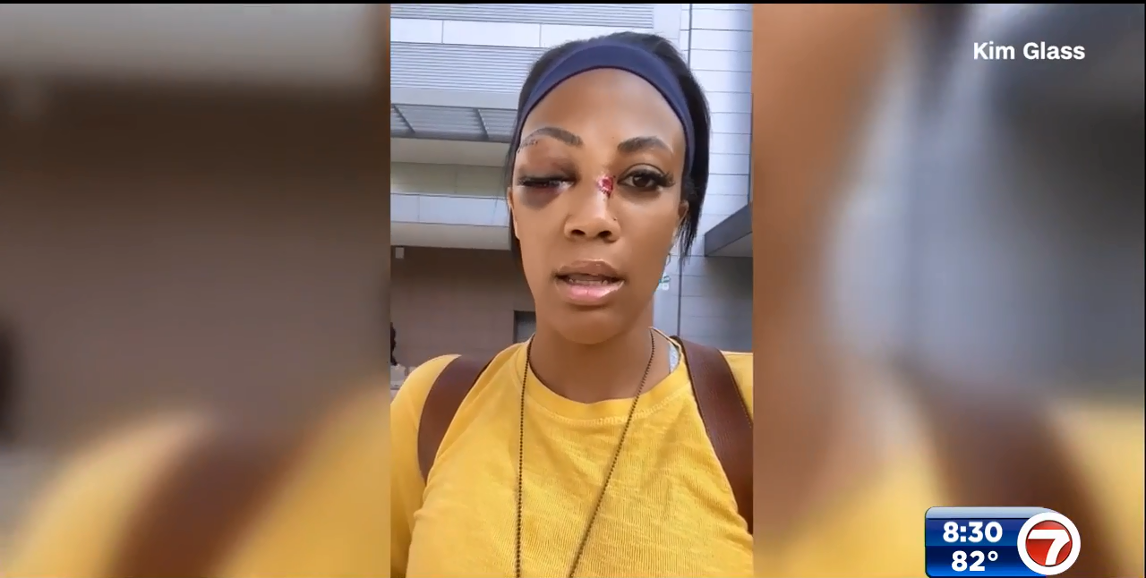 Olympian injured in downtown Los Angeles attack - WSVN 7News | Miami ...