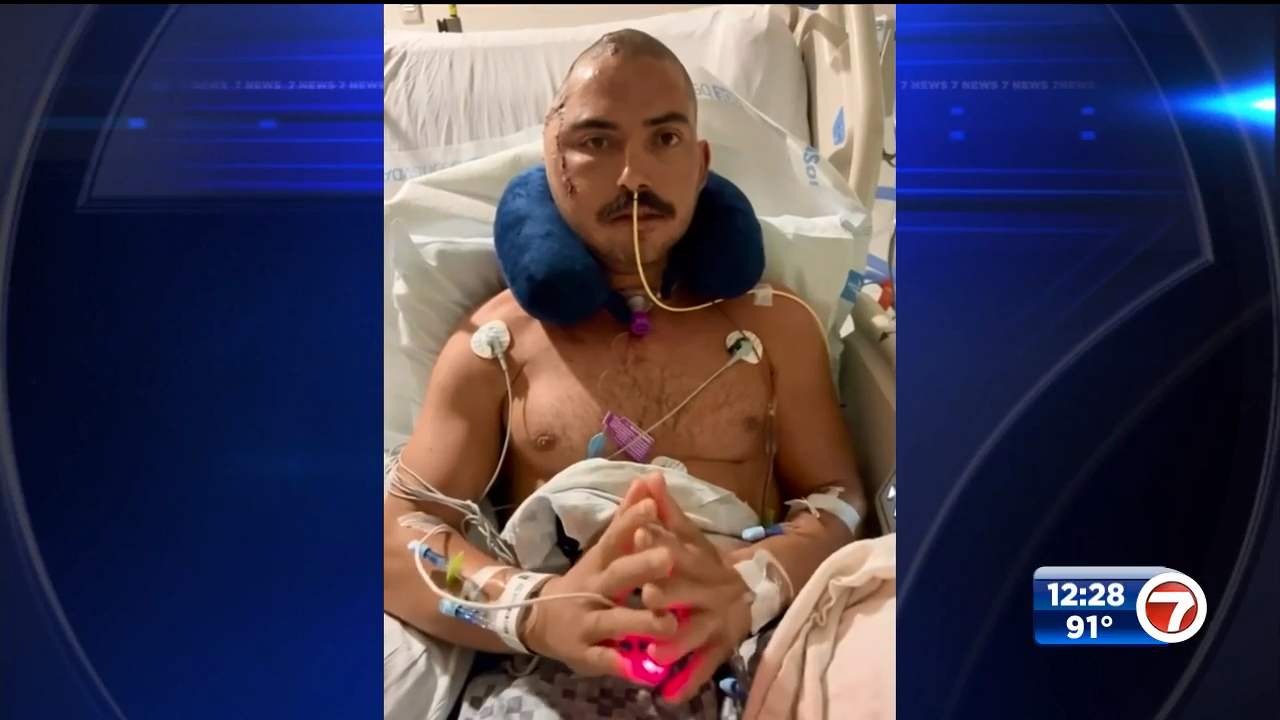 Man recounts alligator attack after coming home from hospital - WSVN ...