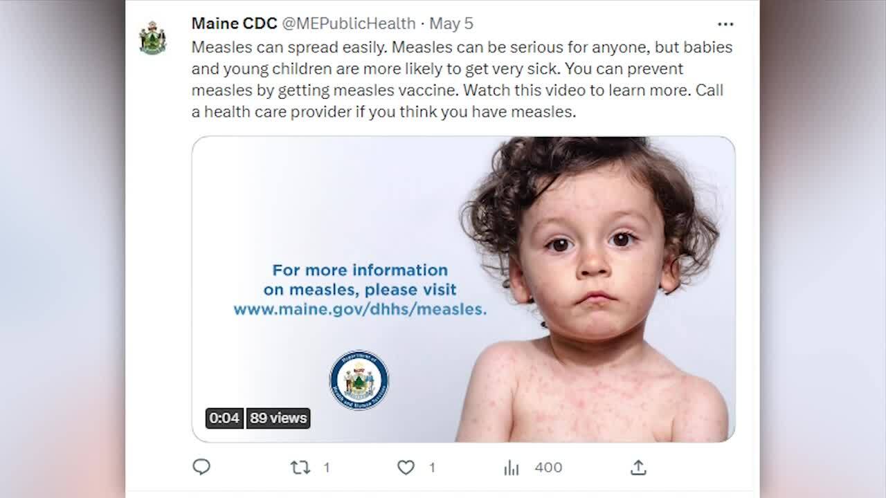 Child in Maine tests positive for measles, first case in state since ...