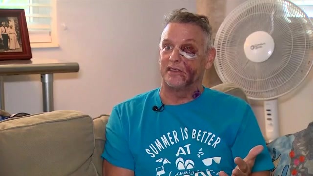 ‘God left me there for a reason’: Coconut Grove man home from hospital ...