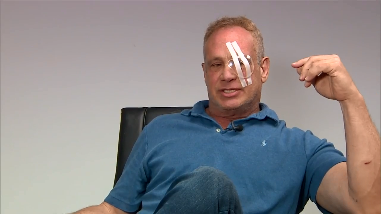 62-year-old father shot in eye by water bead gun in Palmetto Bay pushes ...