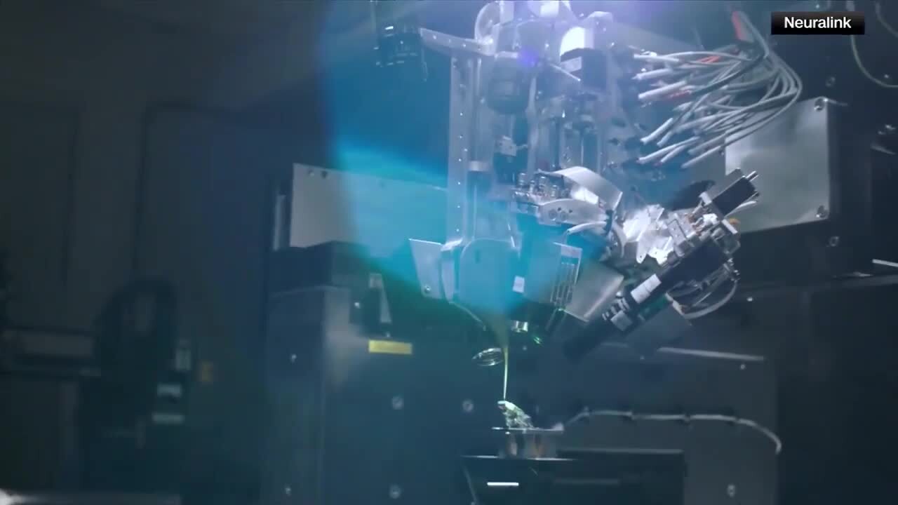 Neuralink’s first brain chip implant developed a problem — but there ...