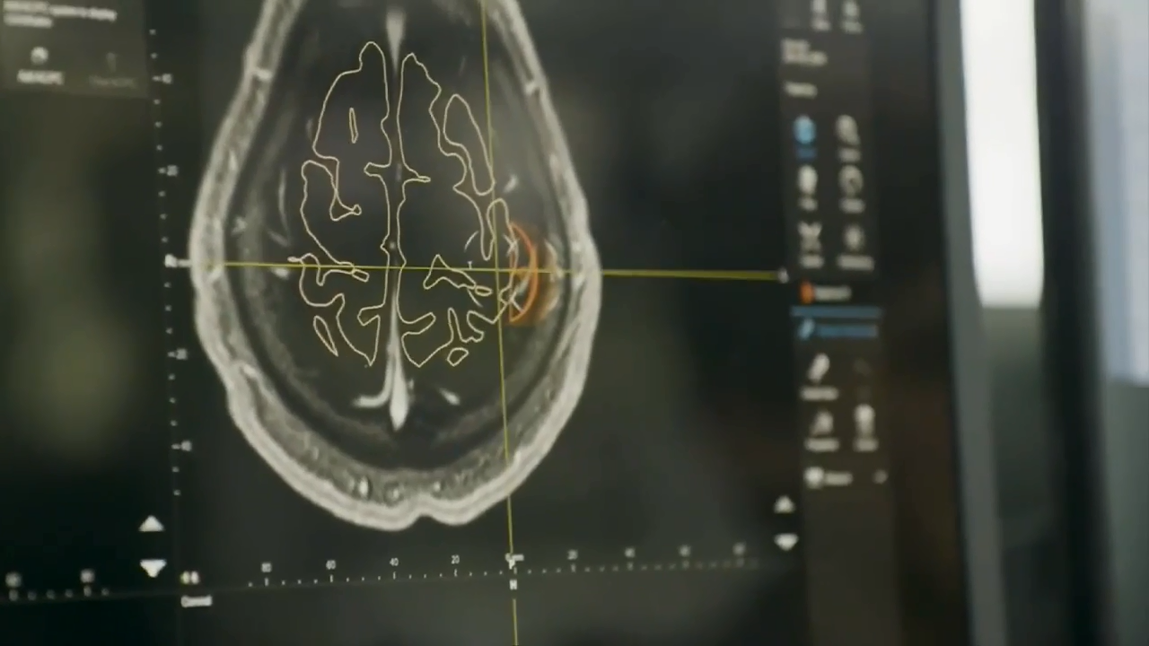 Elon Musk’s Neuralink is seeking a second person to test its brain chip ...