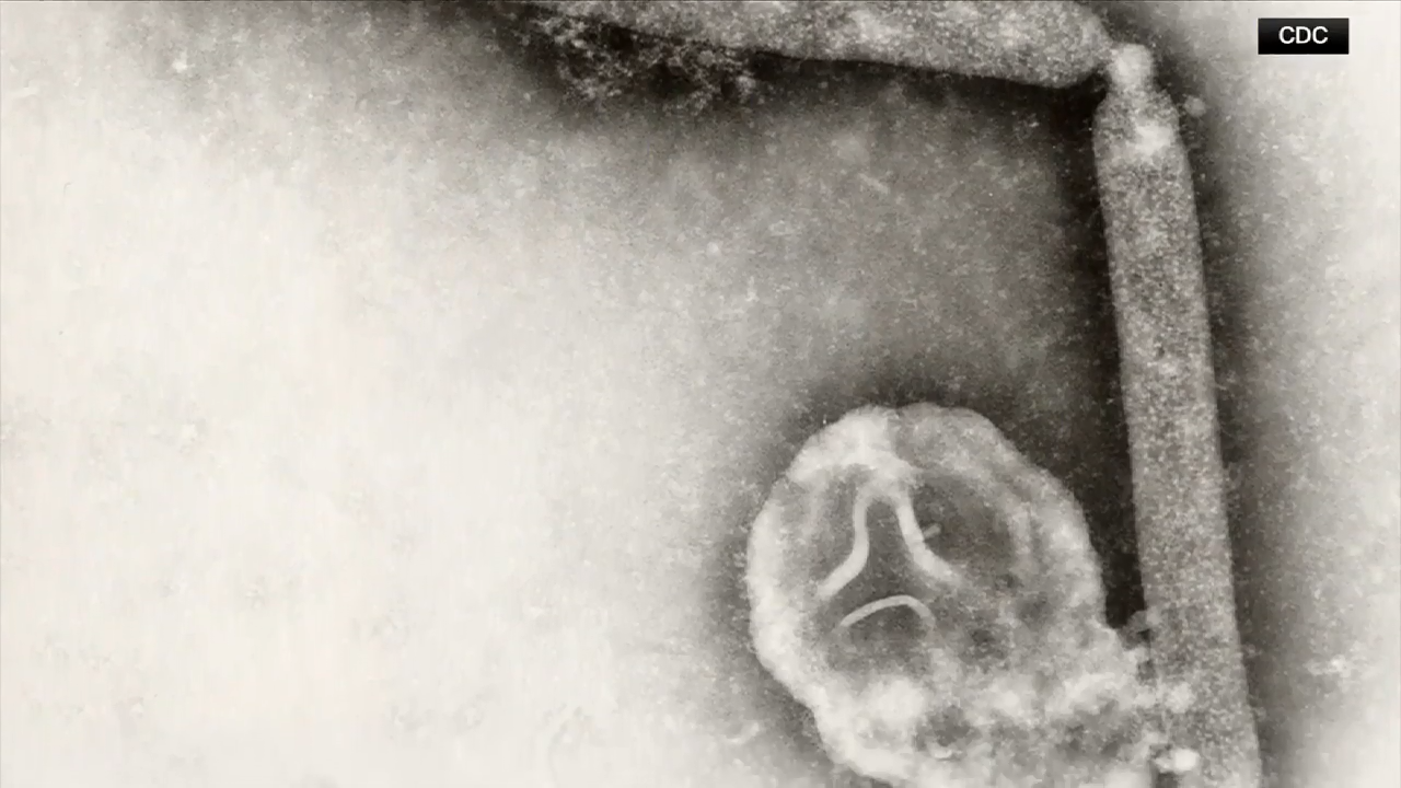 Michigan farmworker diagnosed with bird flu, becoming 2nd US case tied ...