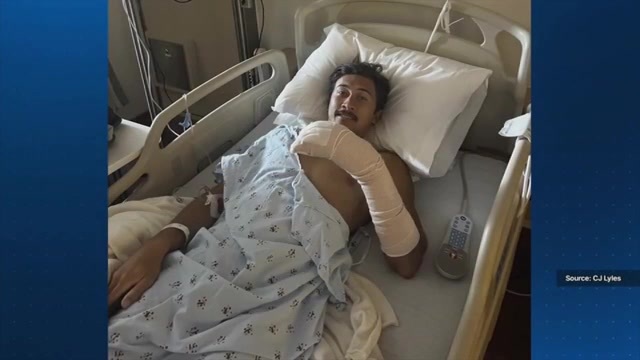 Firefighter recovering from hand injury after shark attack while ...