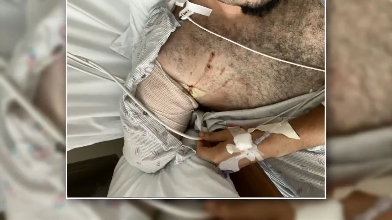 Florida man who lost arm in gator attack speaks out 1 year later - WSVN ...
