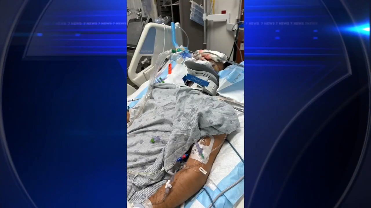 Boss of scooter rider injured in head-on collision in Miami speaks out ...