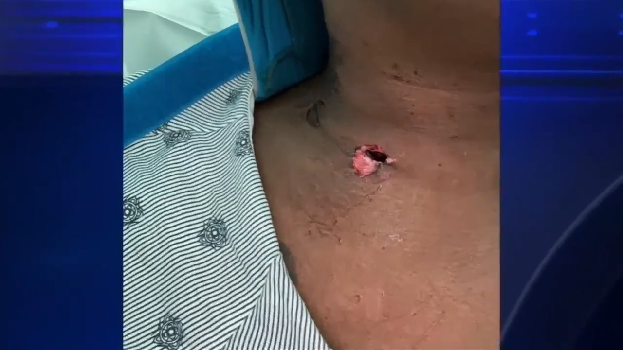 Woman in recovery after being shot in the neck while driving with 5 ...