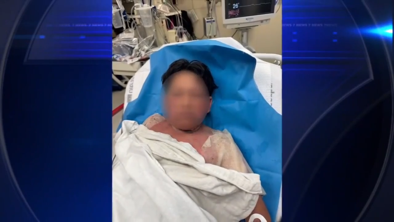 Displaced family staying in hotel after fire engulfs Davie home; child ...