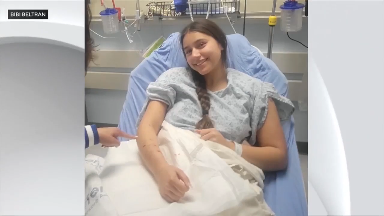 California teenager recovering after sea lion attack - WSVN 7News ...