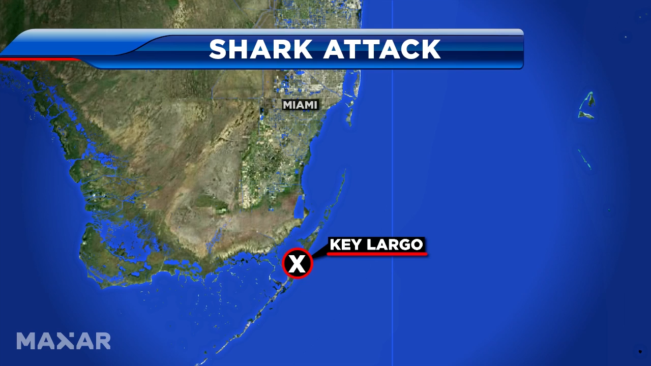 8-year-old boy hospitalized after being bitten by shark in Key Largo ...